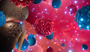 Otezla Video Library About Plaque Psoriasis, PsA, and Oral Ulcers in ...